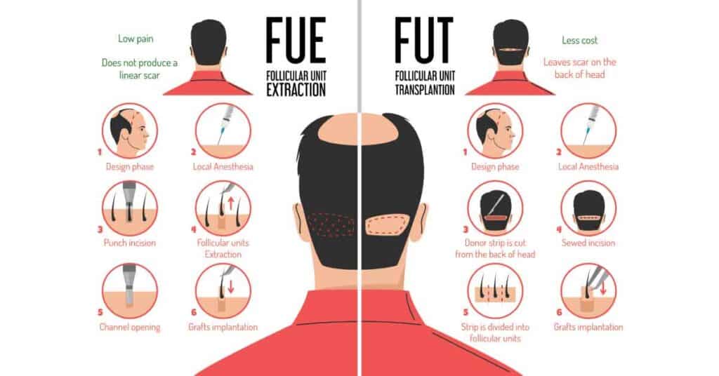 FUE vs FUT Procedures | Austin Hair Restoration Clinic