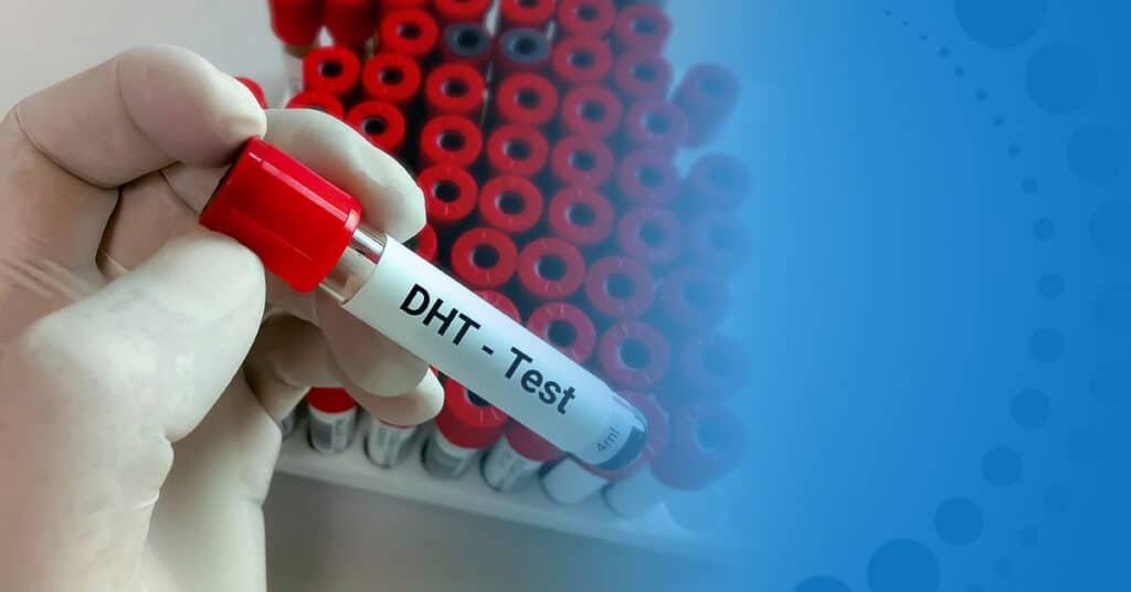 What Does DHT Do To Hair? | Austin Hair Restoration Clinic